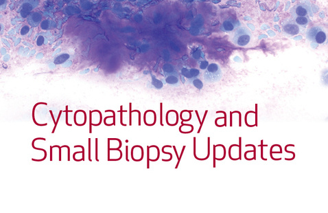Cytopathology and Small Biopsy Updates - Houston Methodist Academic ...